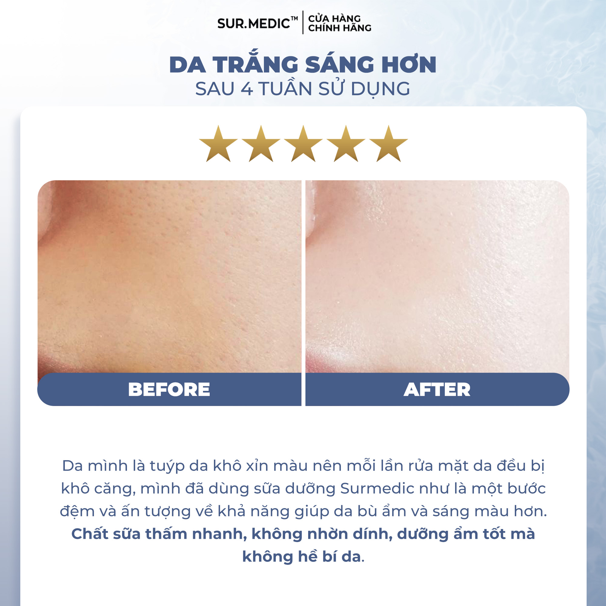 Magic Water Duo + 1 Box of Surmedic Whitening and Anti-Aging Mask 420ml ...