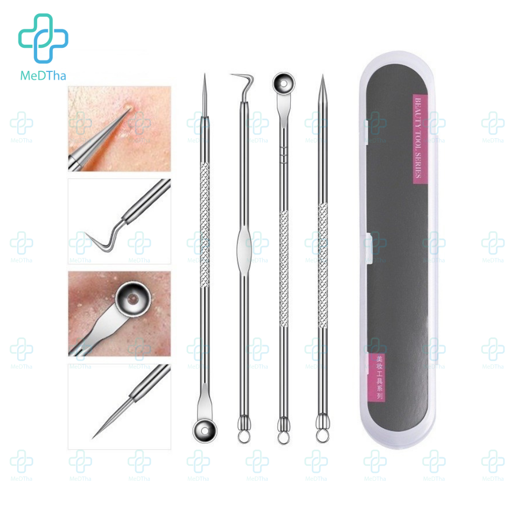 Acne Extraction Tool Set 5 Piece - Removes Blackheads, Acne, Stainless ...
